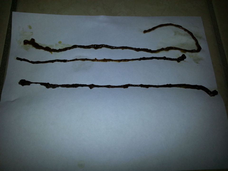 What is this exactly? Worm or mucoid plaque? On 11" paper at Ask ...