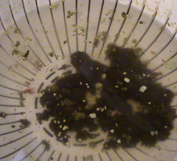 Grains Of Rice In Poop at Kenneth Mcgray blog